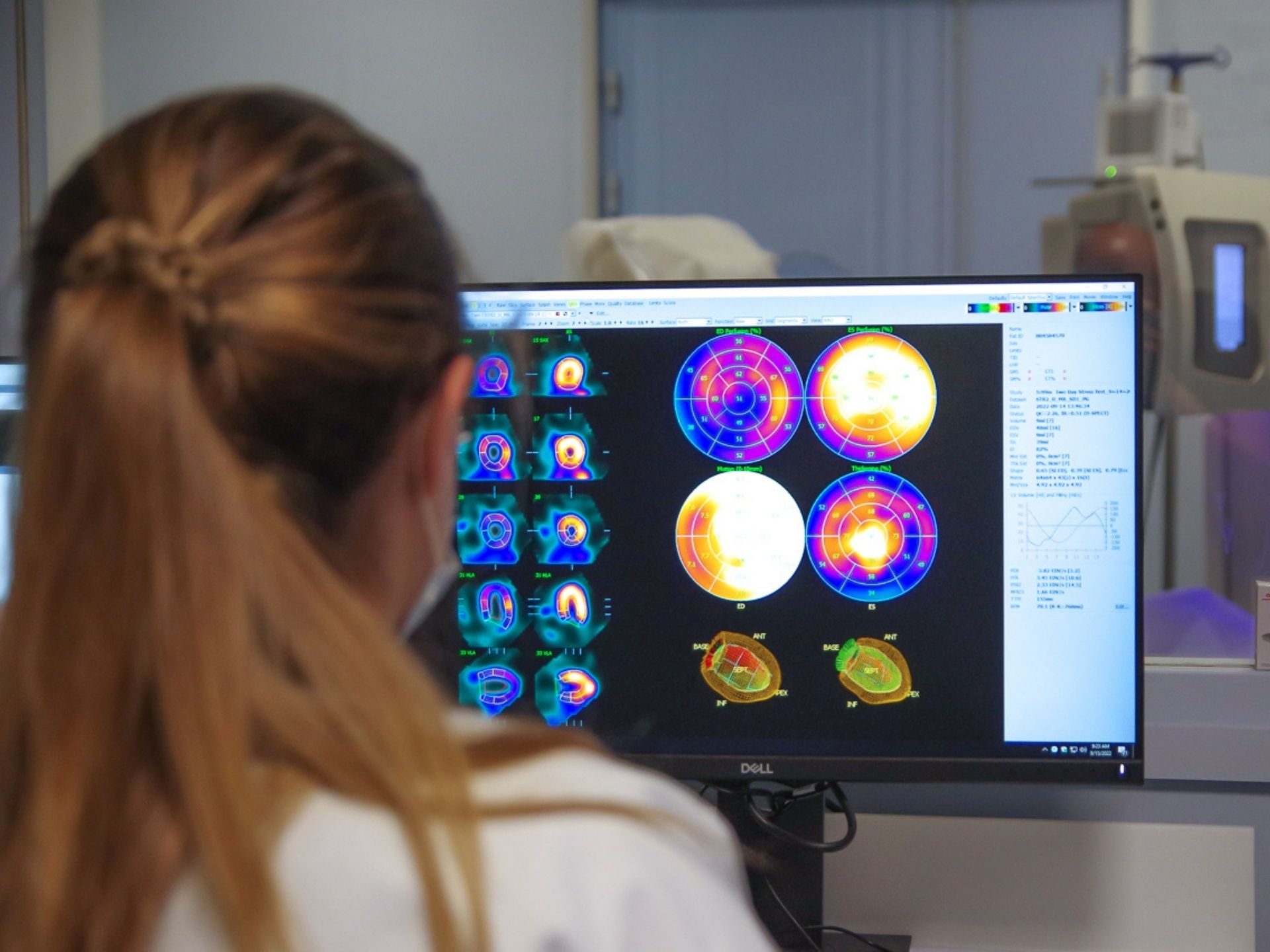 Tep scan - Centre Hospitalier Simone Veil de Beauvais